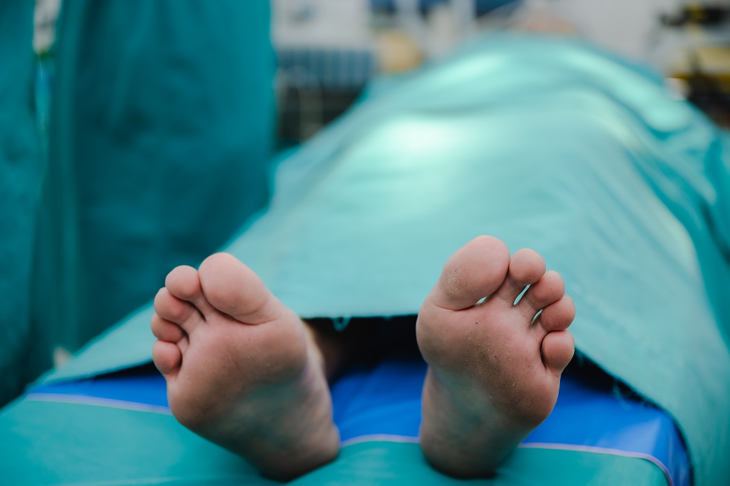 Cadaver Transport (Import)